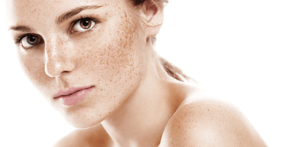 Common Skin Problems after Overexposure to Sun