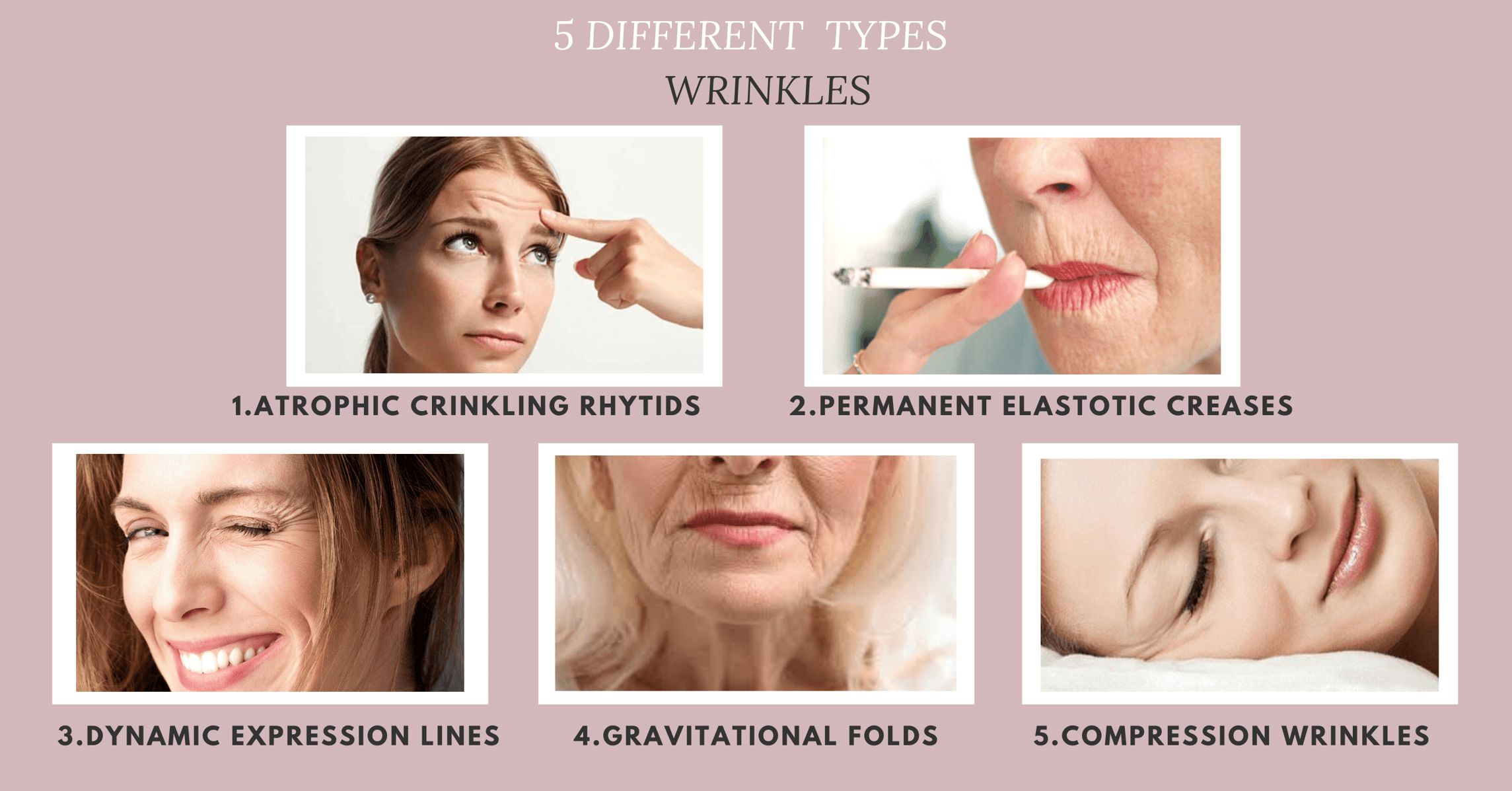 Understanding Wrinkles and Fine Lines