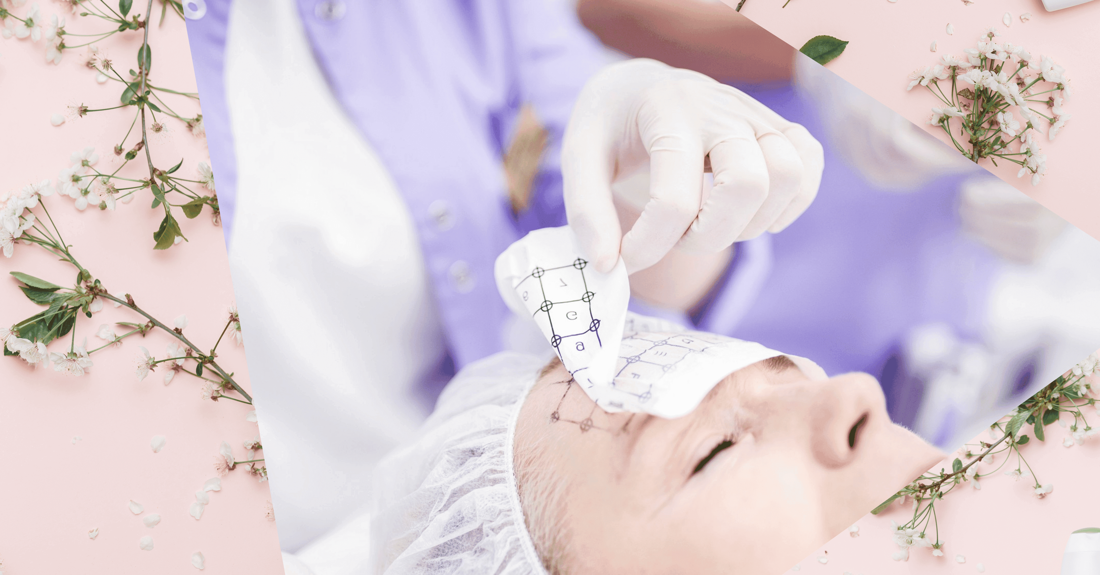 Thermage, Ultherapy Treatments at Home